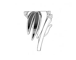 Leaf Ring Inlay | Rosewood – Marc Alary